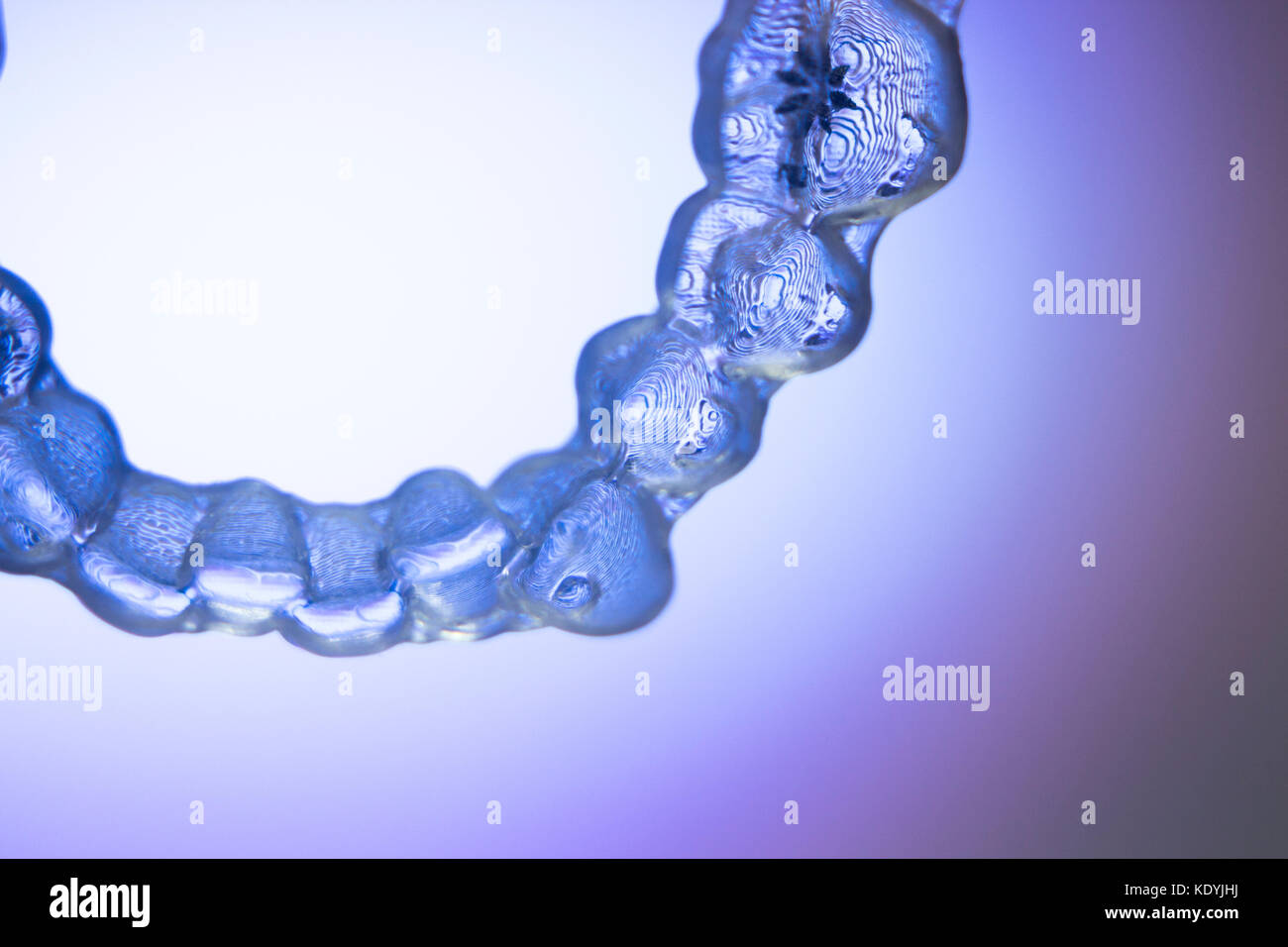 Invisible teeth retainers orthodontic brackets. Plastic modern ...