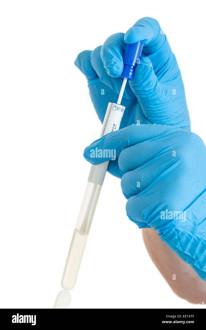 Swab specimen hi-res stock photography and images - Alamy