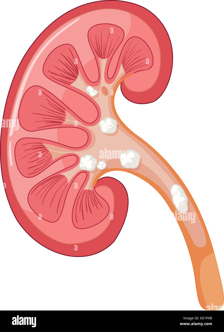Diagram of kidney having problem illustration Stock Vector Image & Art ...
