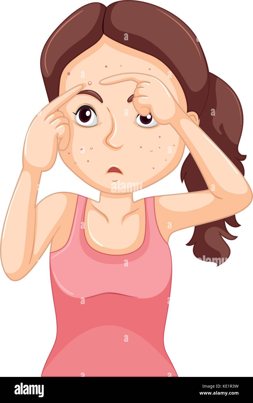 Zit squeeze Stock Vector Images - Alamy
