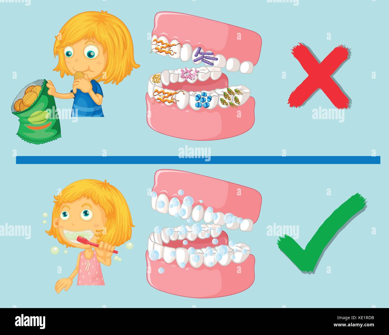 Girl with dirty and clean teeth illustration Stock Vector Image & Art ...