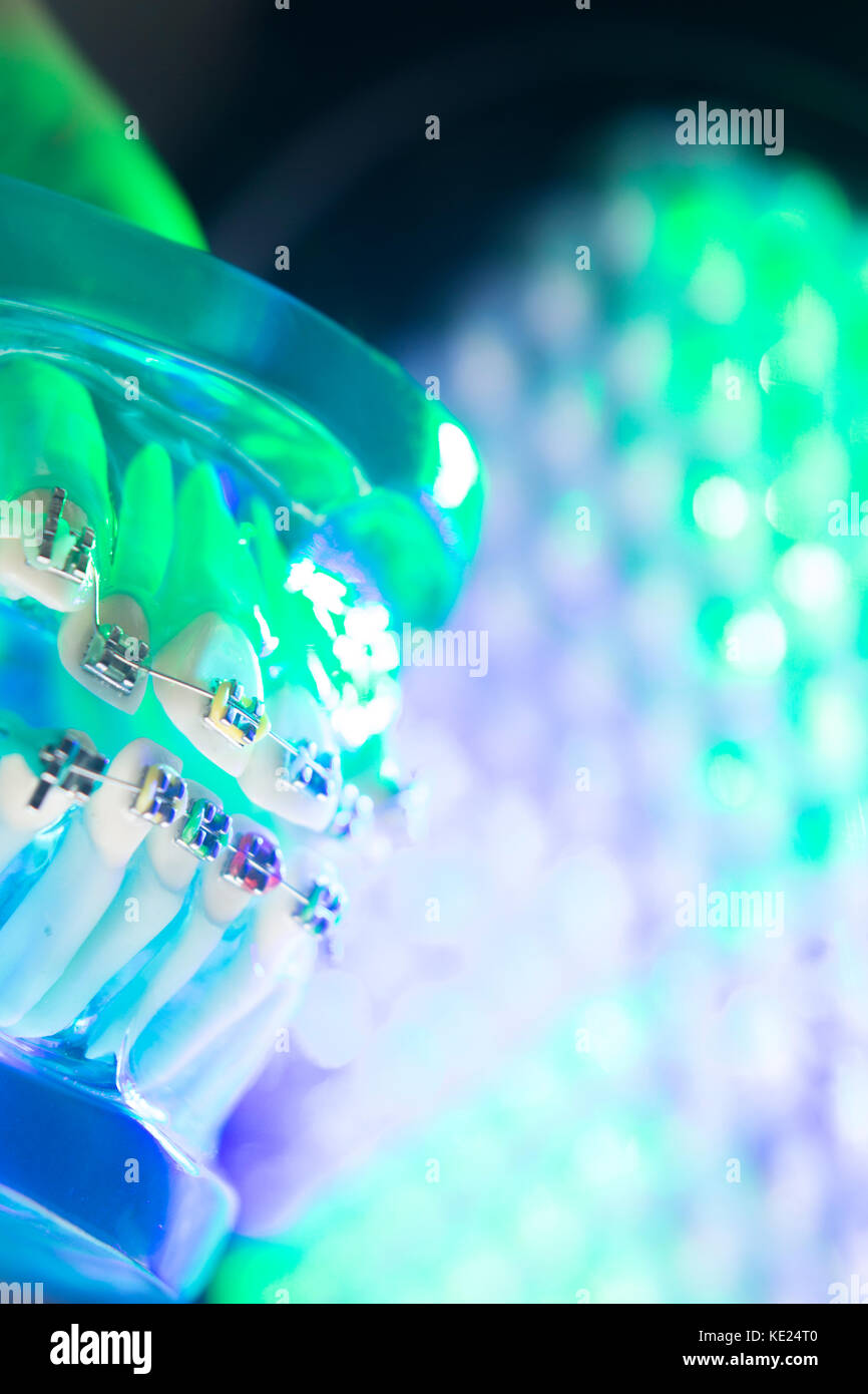 Dental teeth retainers metal aligners brackets to straighten teeth in ...