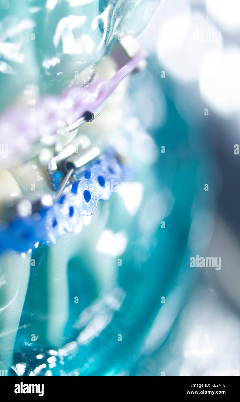 Dental teeth retainers metal aligners brackets to straighten teeth in ...