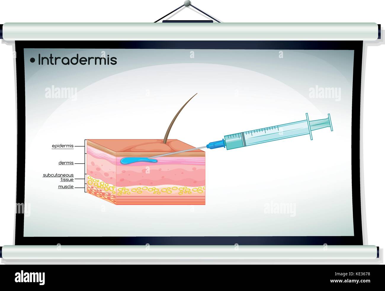 Syringe diagram human body hi-res stock photography and images - Alamy
