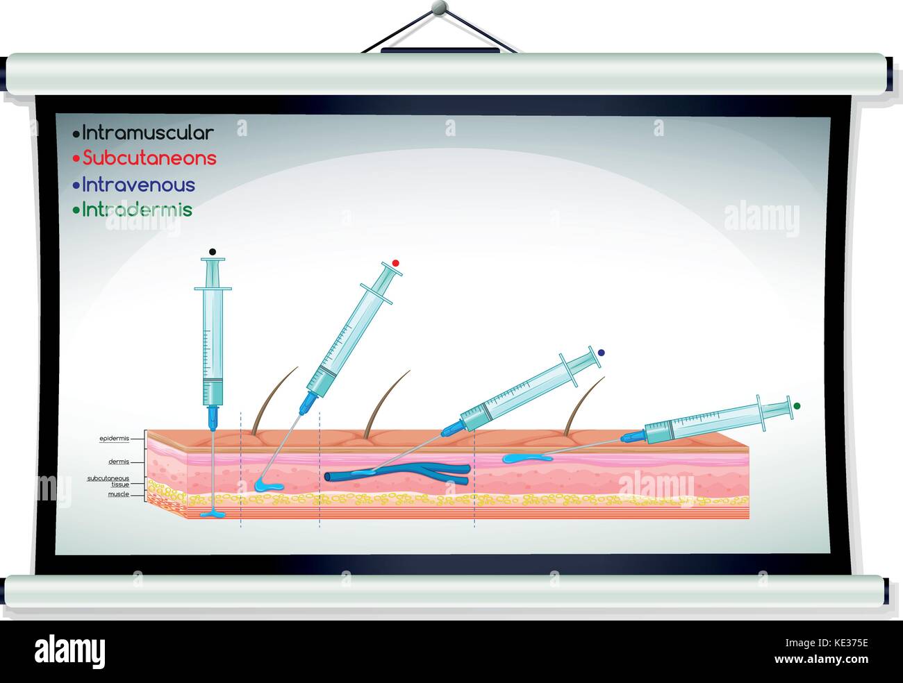 Injection diagram with syringe illustration Stock Vector Image & Art ...