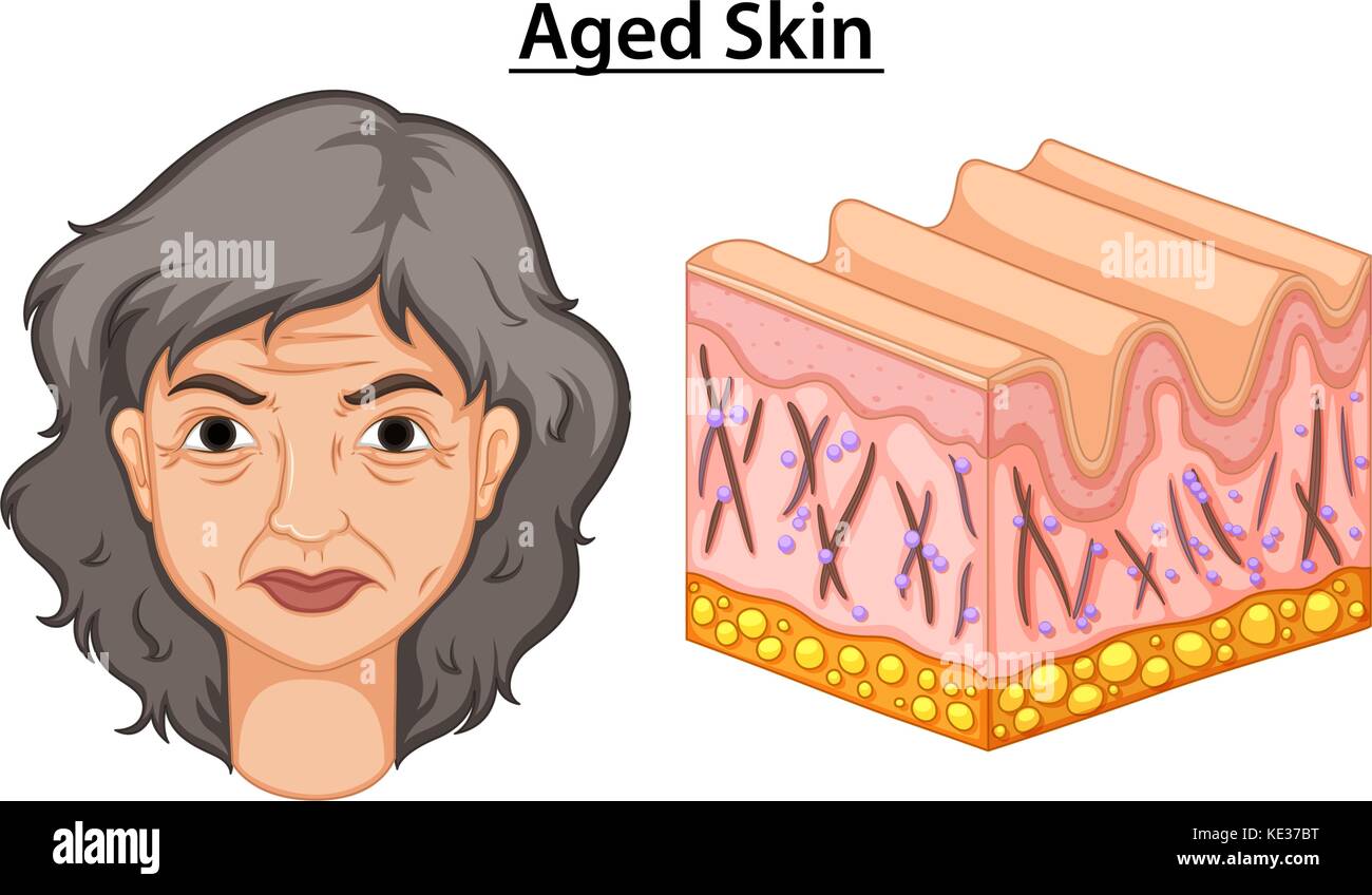 Diagram showing woman with aged skin illustration Stock Vector Image ...