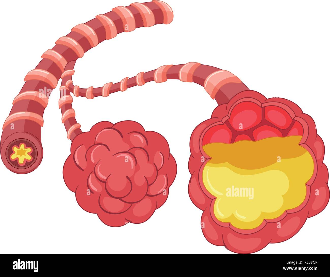 Pneumonia in human lungs illustration Stock Vector Image & Art - Alamy