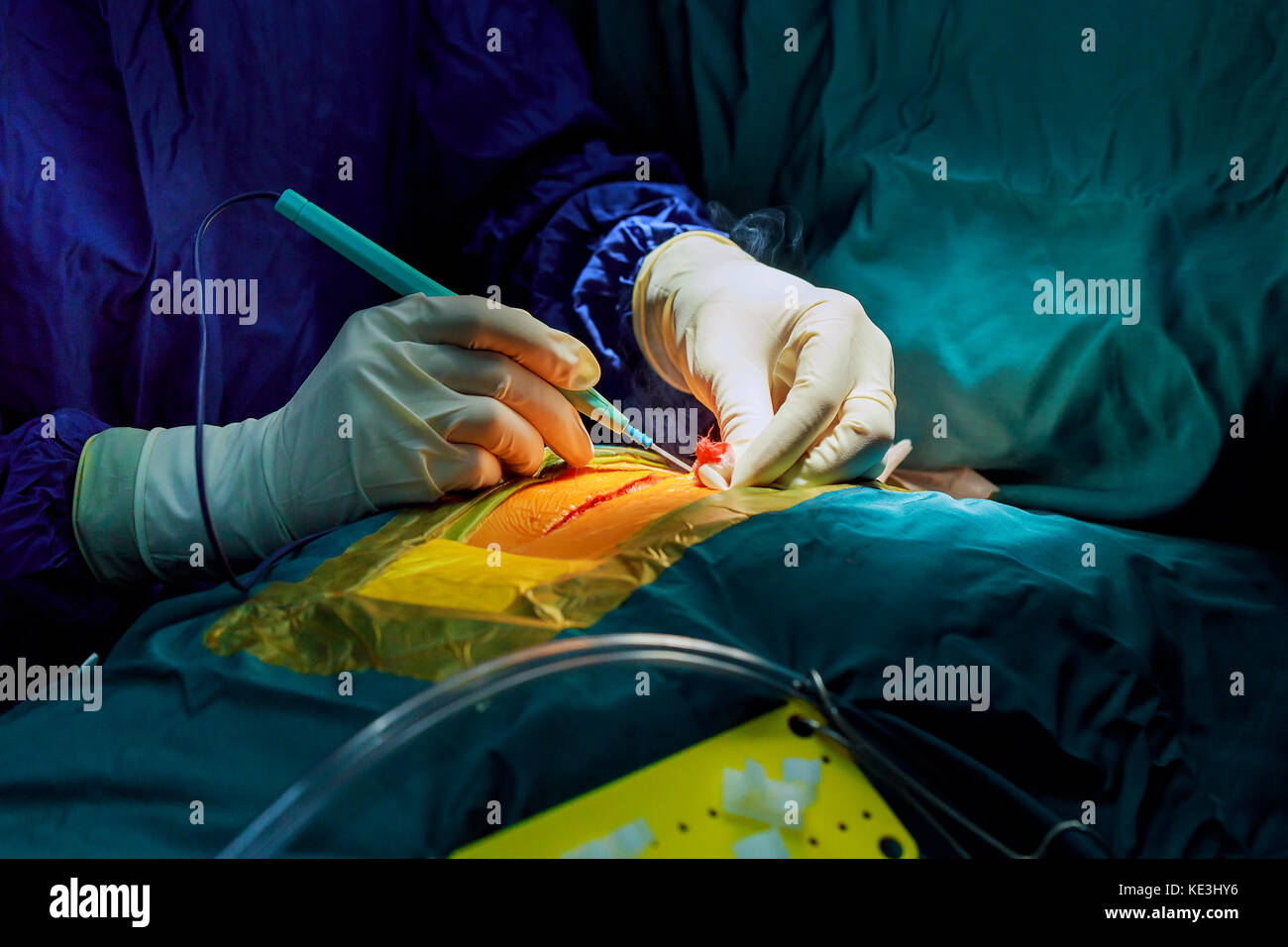 Open chest wound hi-res stock photography and images - Alamy