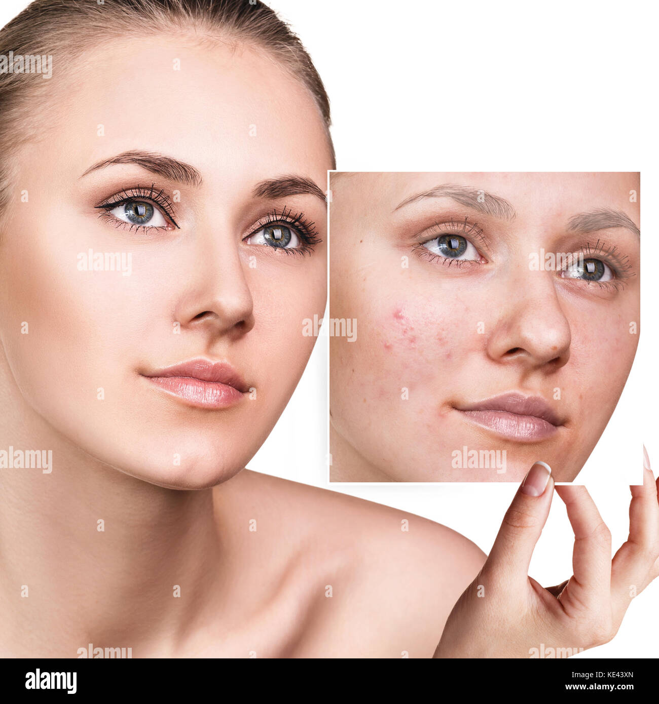 Photo dermatology hi-res stock photography and images - Alamy