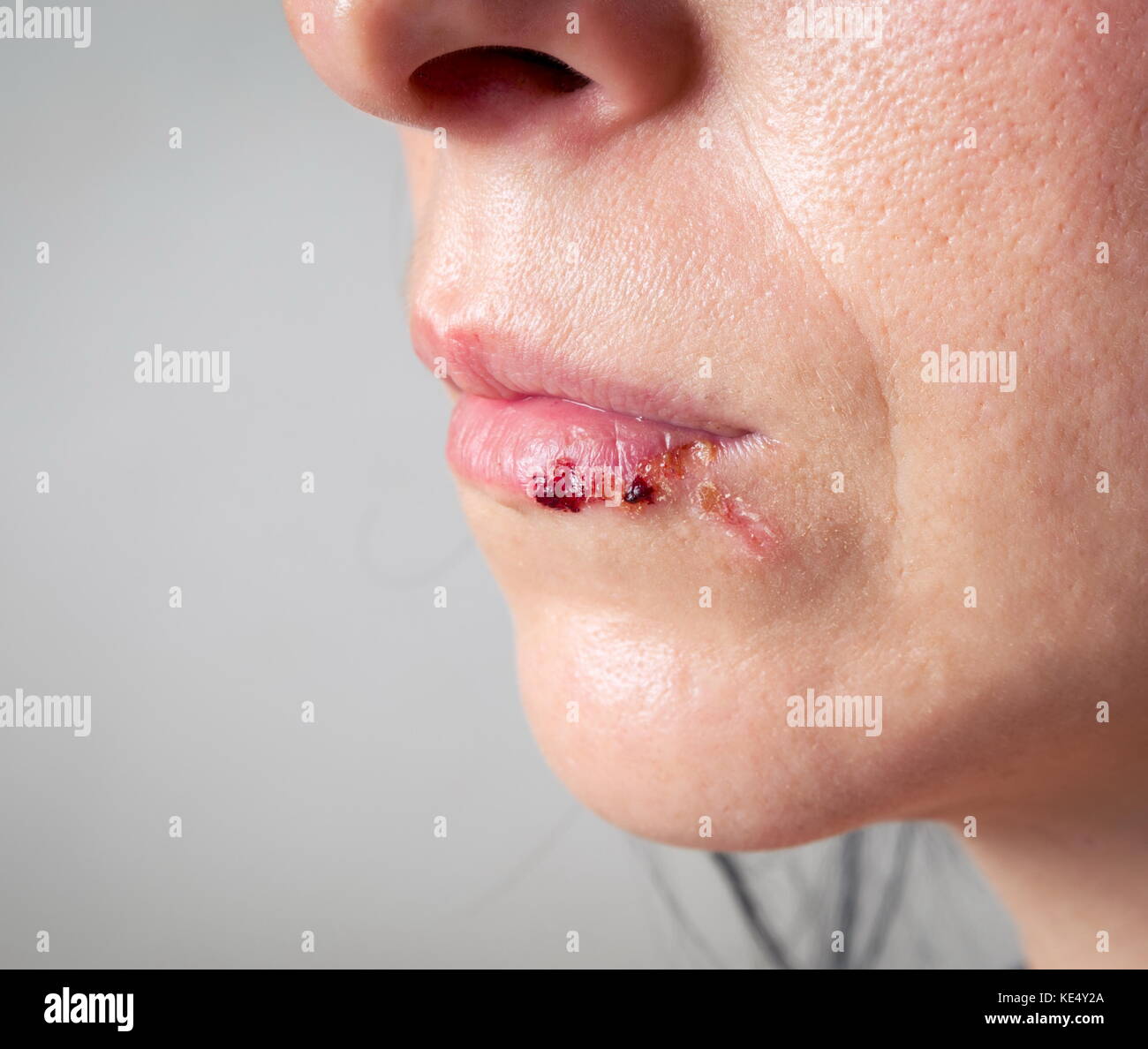 Woman face with injury. Home violence Stock Photo - Alamy