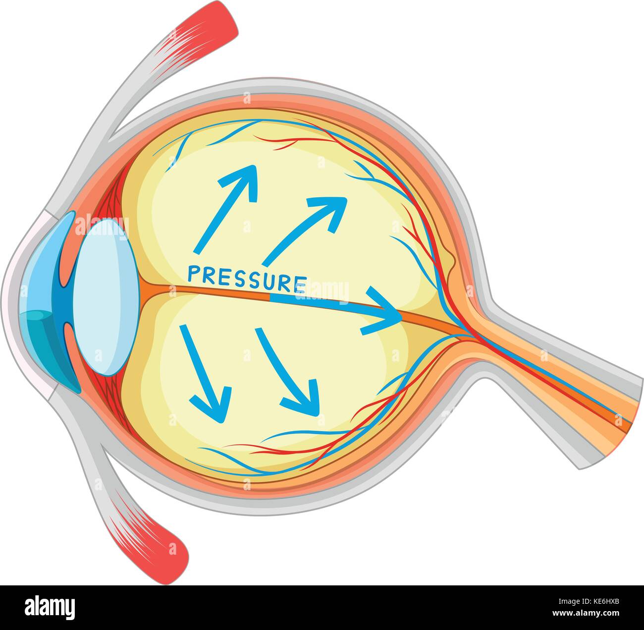 Eyes disease in closer look illustration Stock Vector Image & Art - Alamy