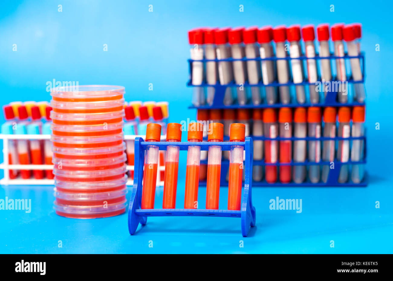 Test tubes with blood for medical and biological analyzes Stock Photo ...