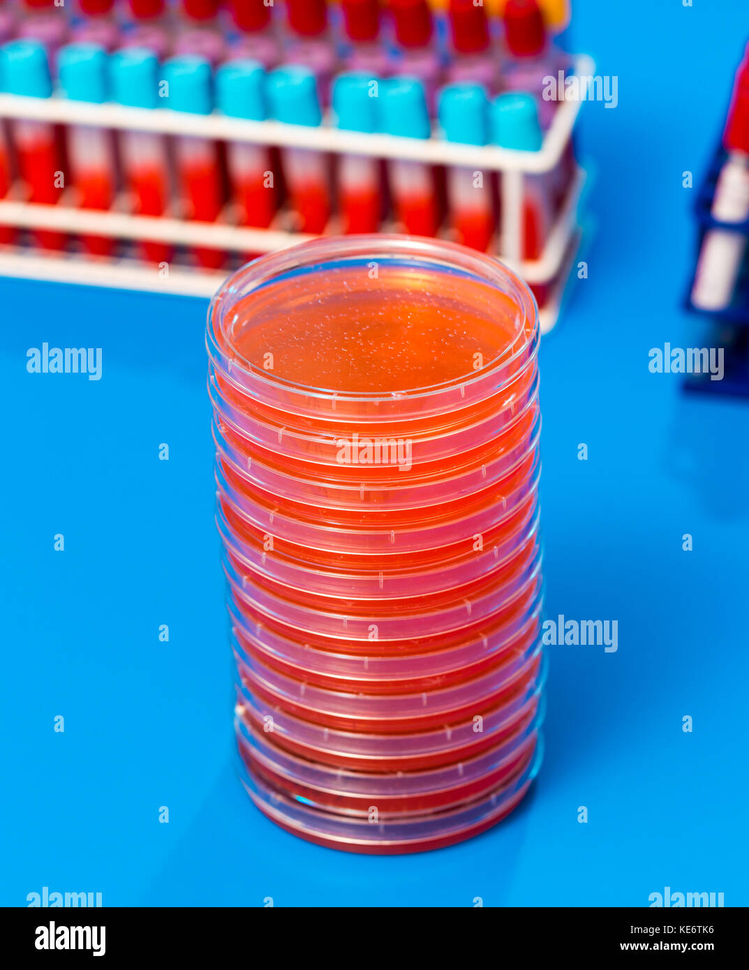 Test tubes with blood for medical and biological analyzes Stock Photo ...