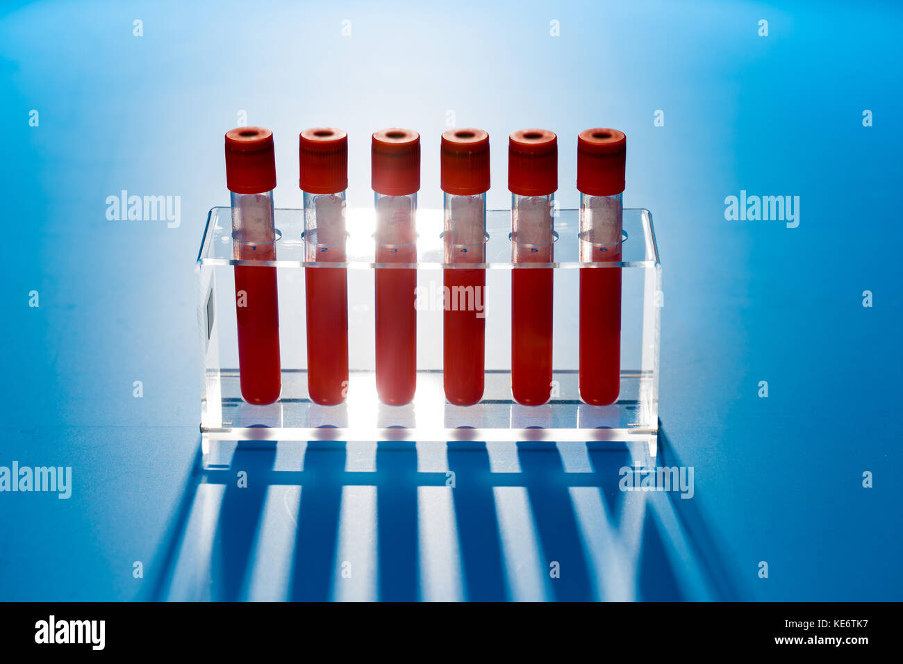 Test tubes with blood for medical and biological analyzes Stock Photo ...