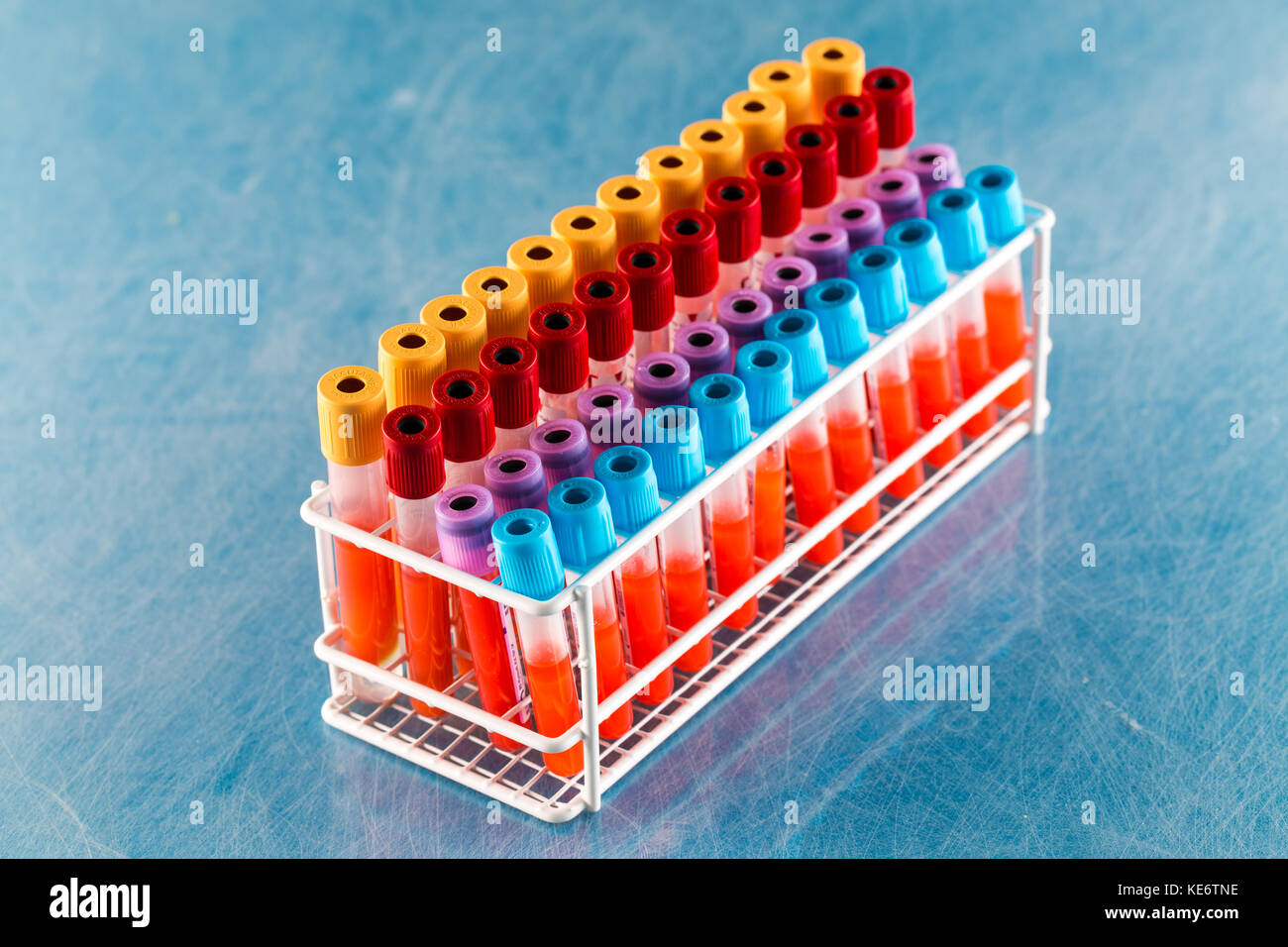 Test tubes with blood for medical and biological analyzes Stock Photo ...