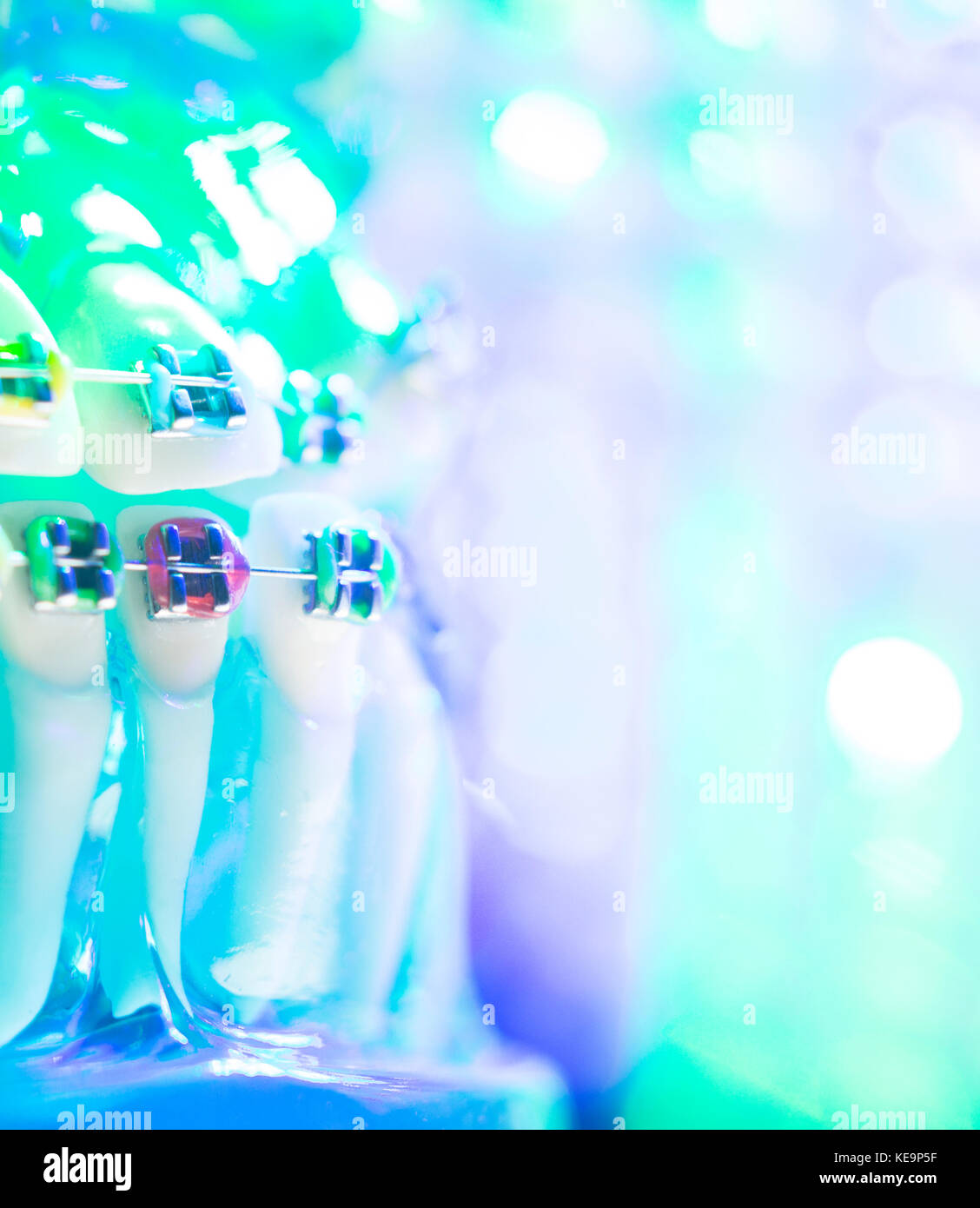 Dental teeth retainers metal aligners brackets to straighten teeth in ...