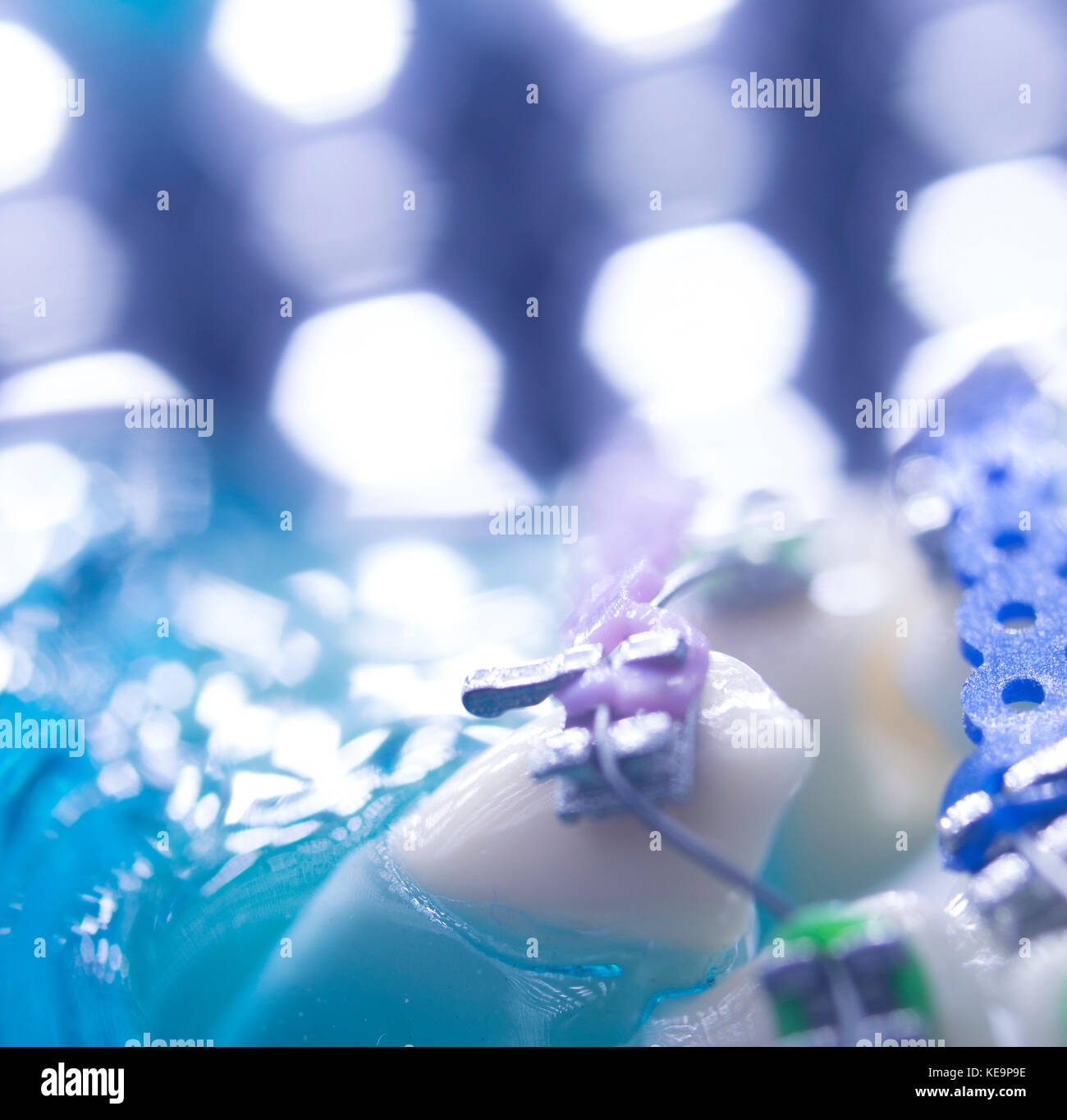 Dental teeth retainers metal aligners brackets to straighten teeth in ...