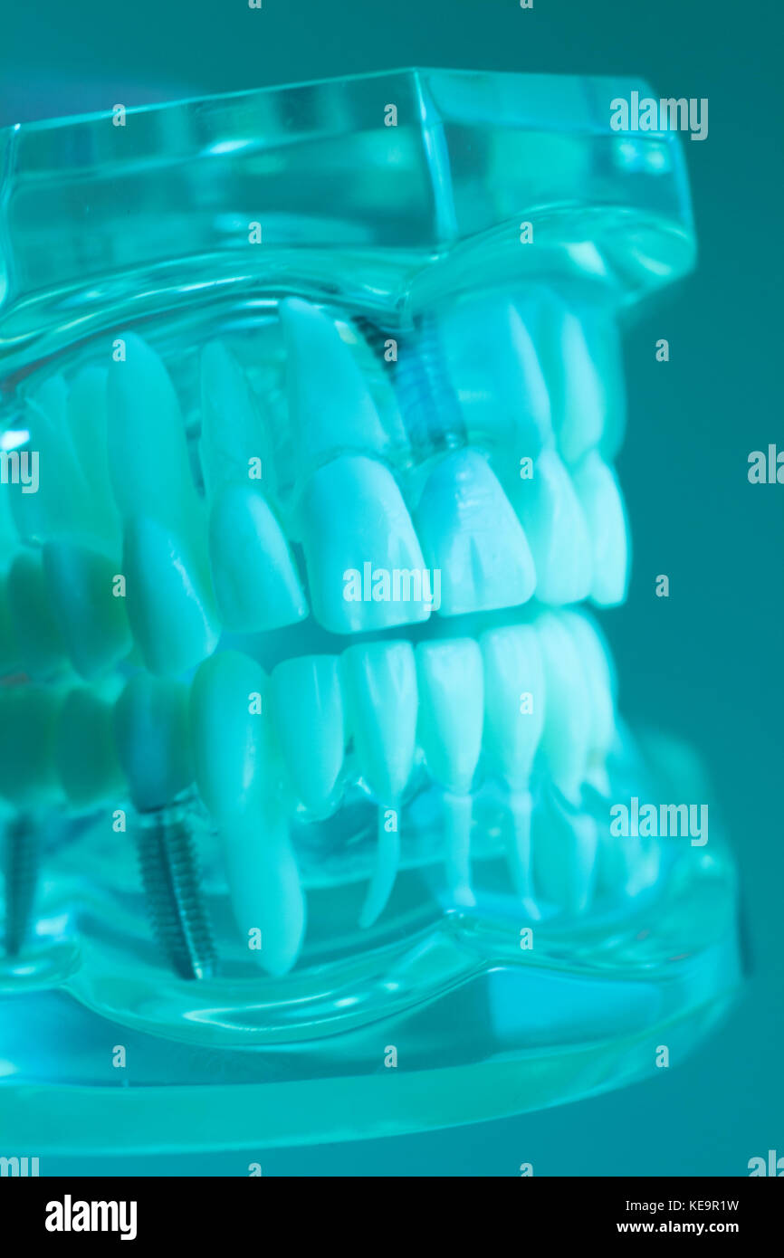 Dental teeth mouth dentists teaching model with teeth, gums, molars and ...