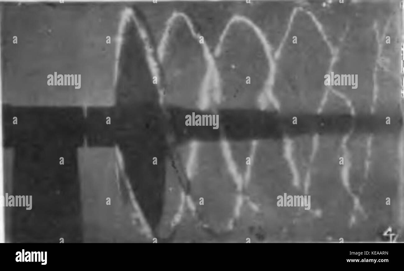 Lawrence bragg x ray hi-res stock photography and images - Alamy