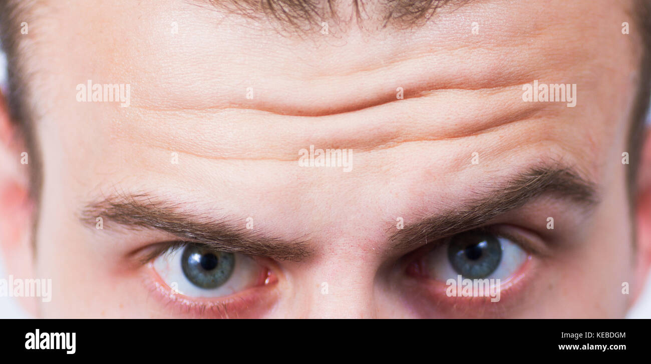 Close-up on wrinkled forehead Stock Photo - Alamy