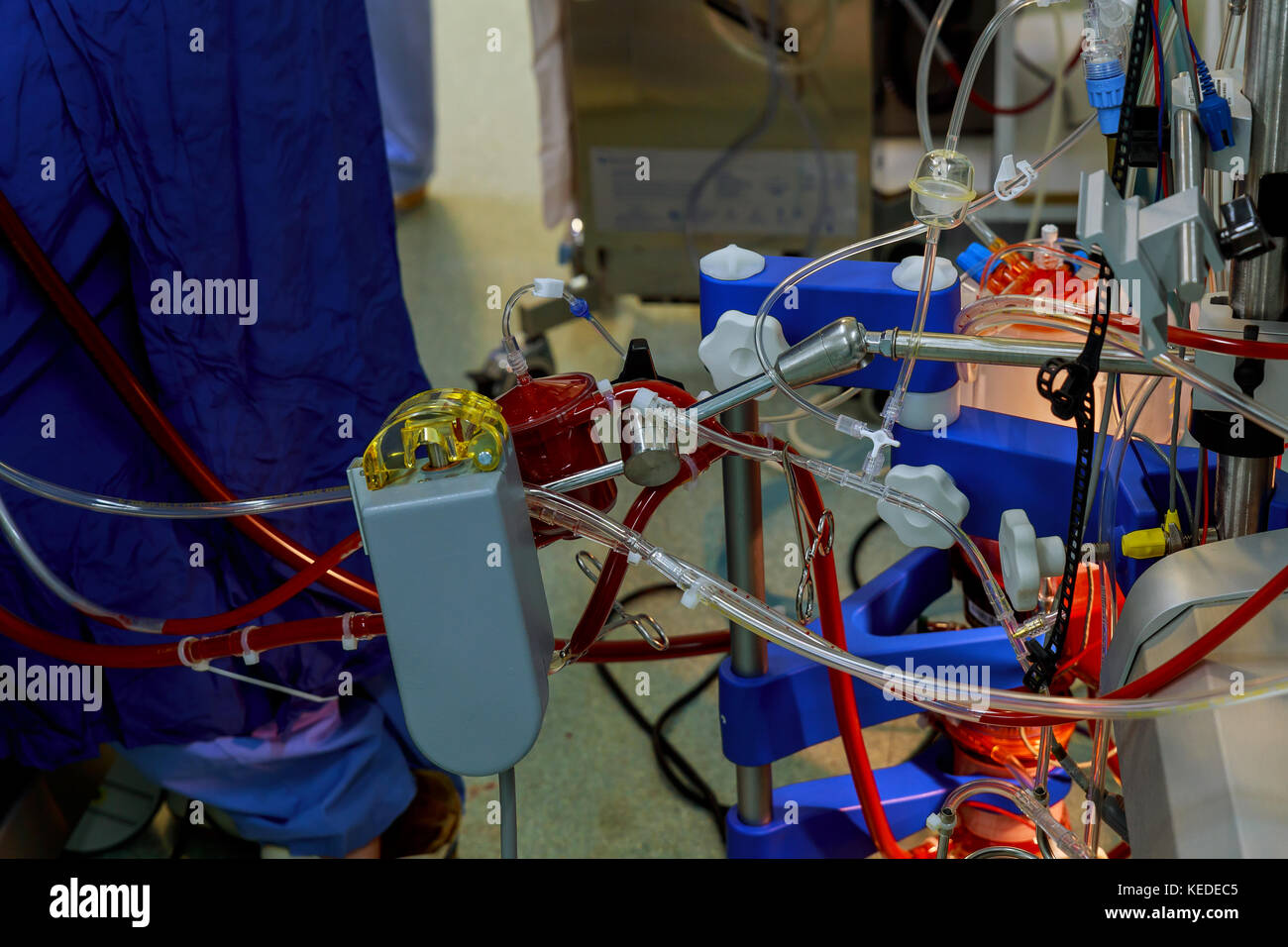 Cardiopulmonary Bypass Cpb Machine Connected And In Use Also Known As The Heart Lung Machine