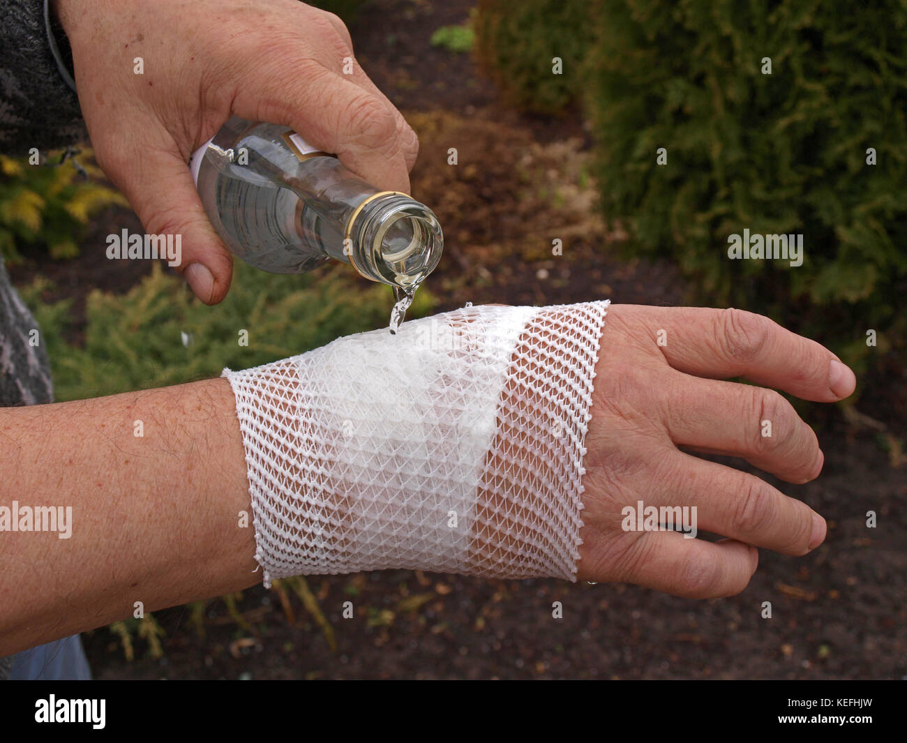 Making alcohol compress on bandaged wrist, close up Stock Photo - Alamy