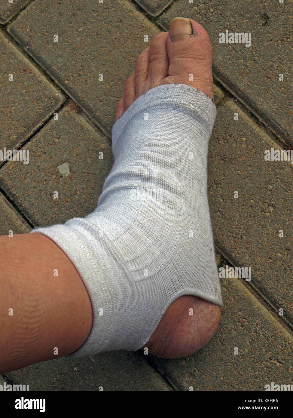 Leg with the orthosis for foot and ankle Stock Photo - Alamy