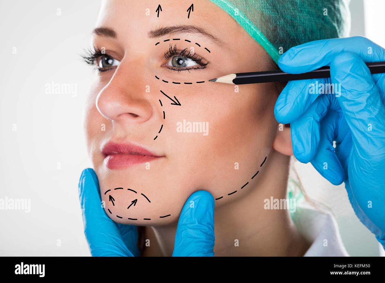 Close-up Of A Surgeon Drawing Perforation Lines On Young Woman's Face ...