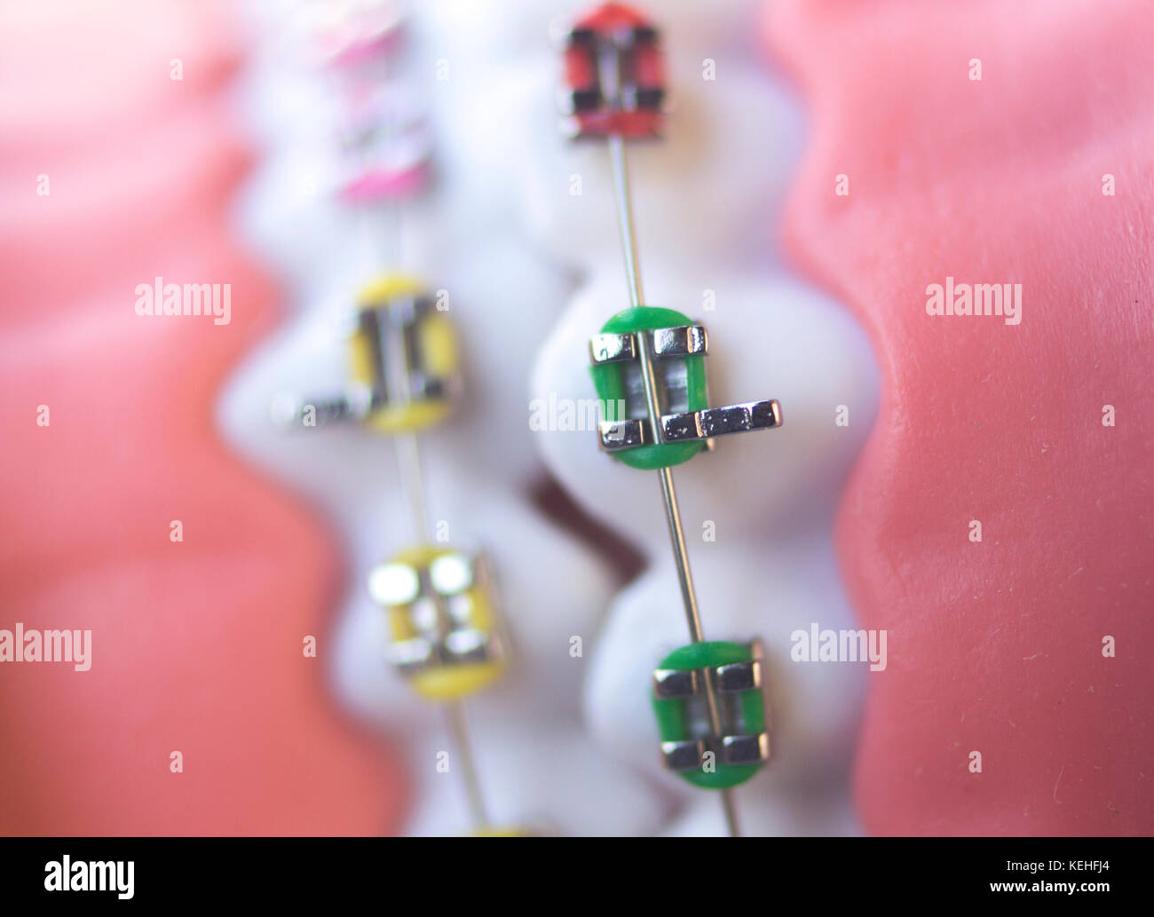 Cosmetic dentistry orthodontics dental metal wire teeth brackets ...