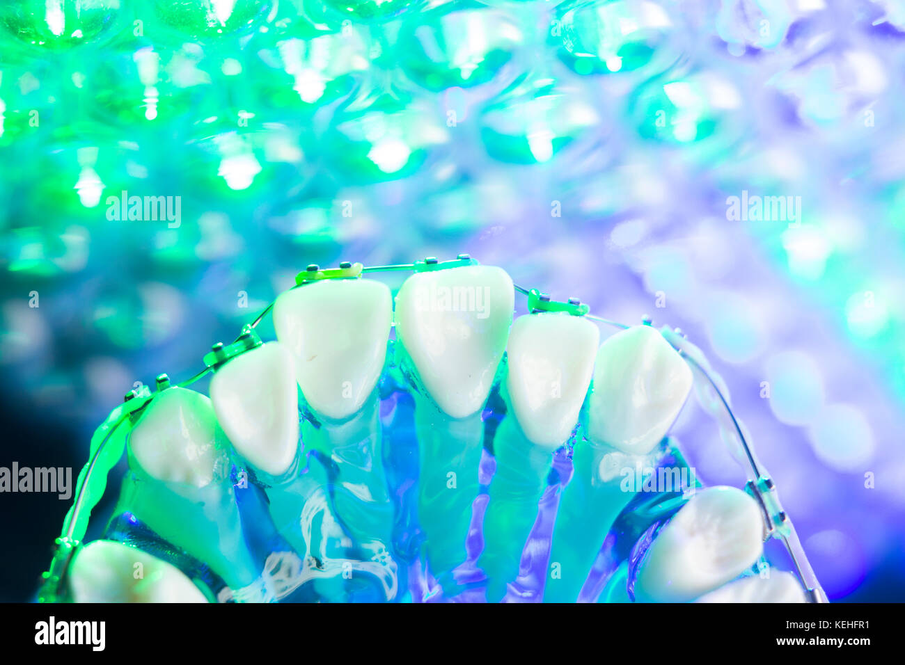 Dental teeth retainers metal aligners brackets to straighten teeth in ...