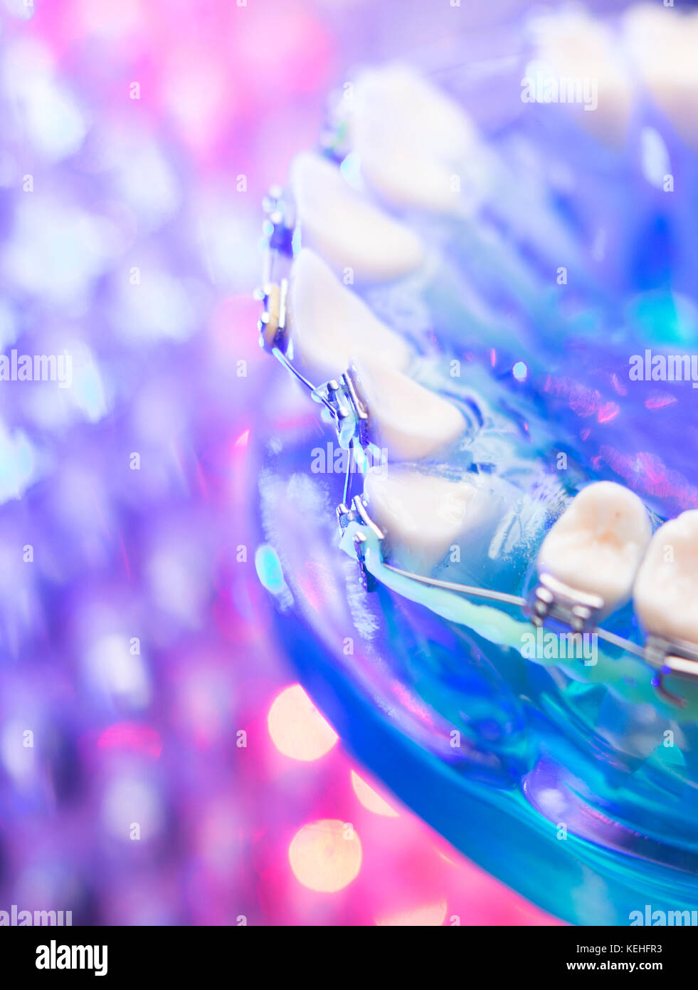 Dental teeth retainers metal aligners brackets to straighten teeth in ...