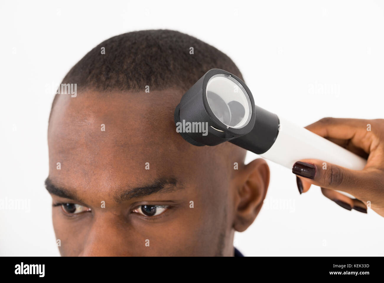 Melanoma on the face hi-res stock photography and images - Alamy