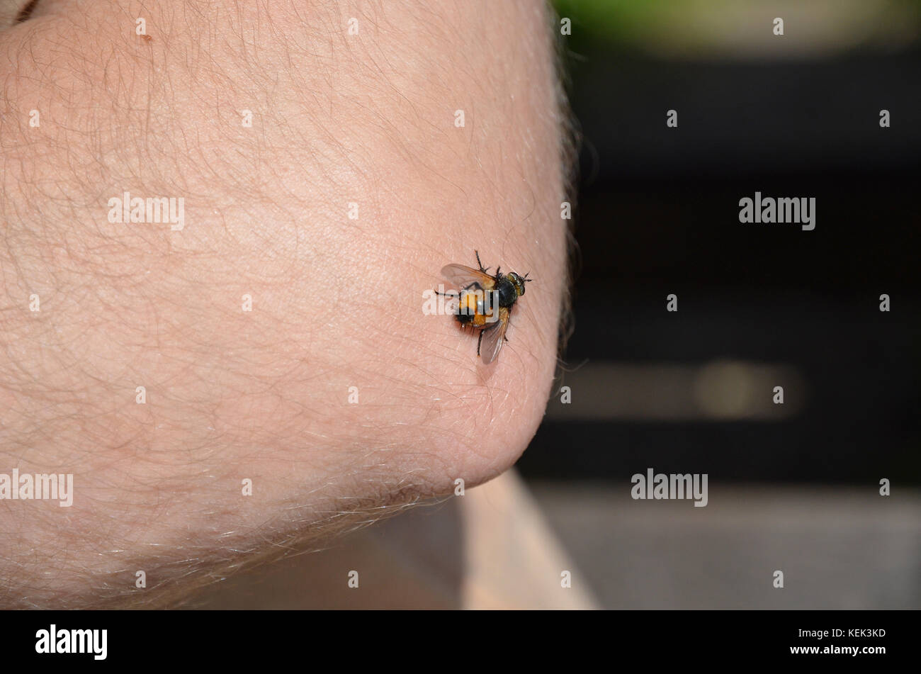 Wasp Stinger Stuck In Skin