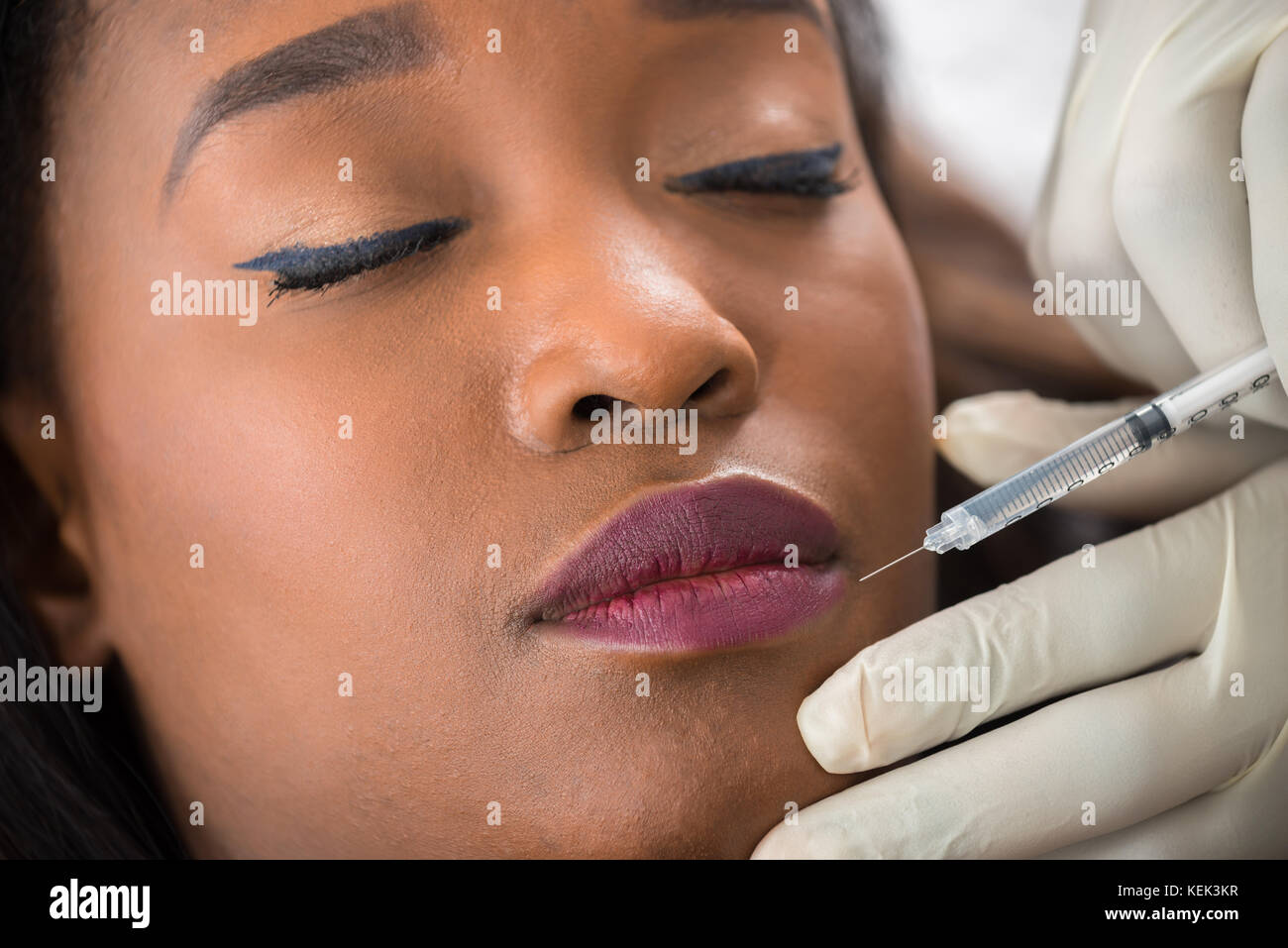 Close-up Of Person Hand Injecting Syringe On Young African Woman Face ...