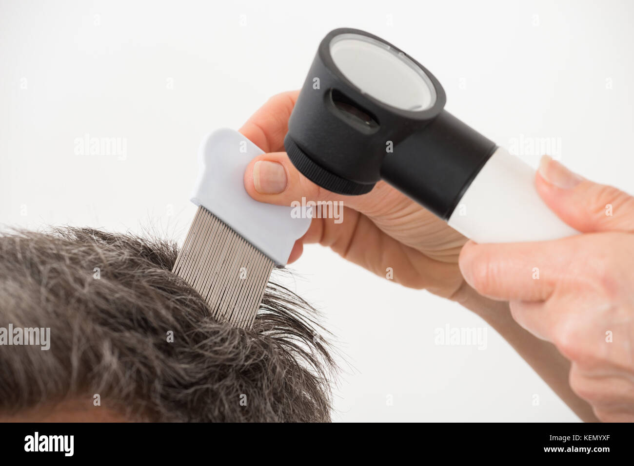 Close-up Of Doctor With Comb And Dermatoscope Examining Patient's Hair ...