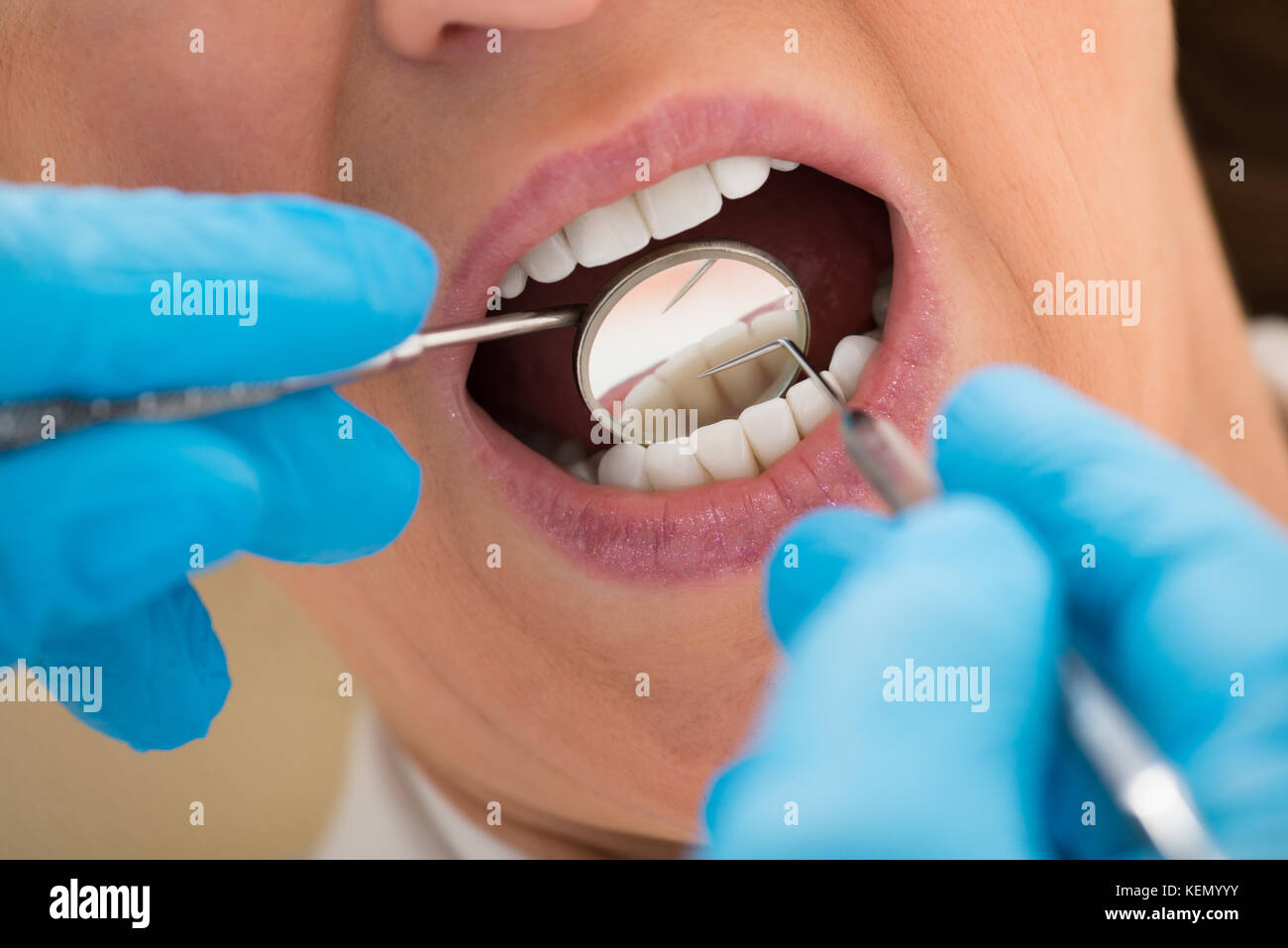 Close-up Of Woman Patient Examining Her Teeth Stock Photo - Alamy