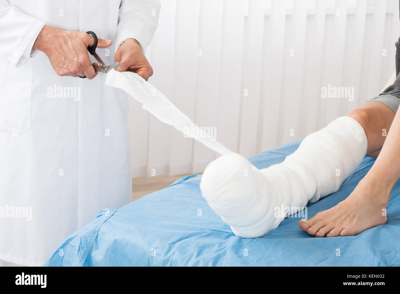 Hospital plaster cast leg hi-res stock photography and images - Alamy