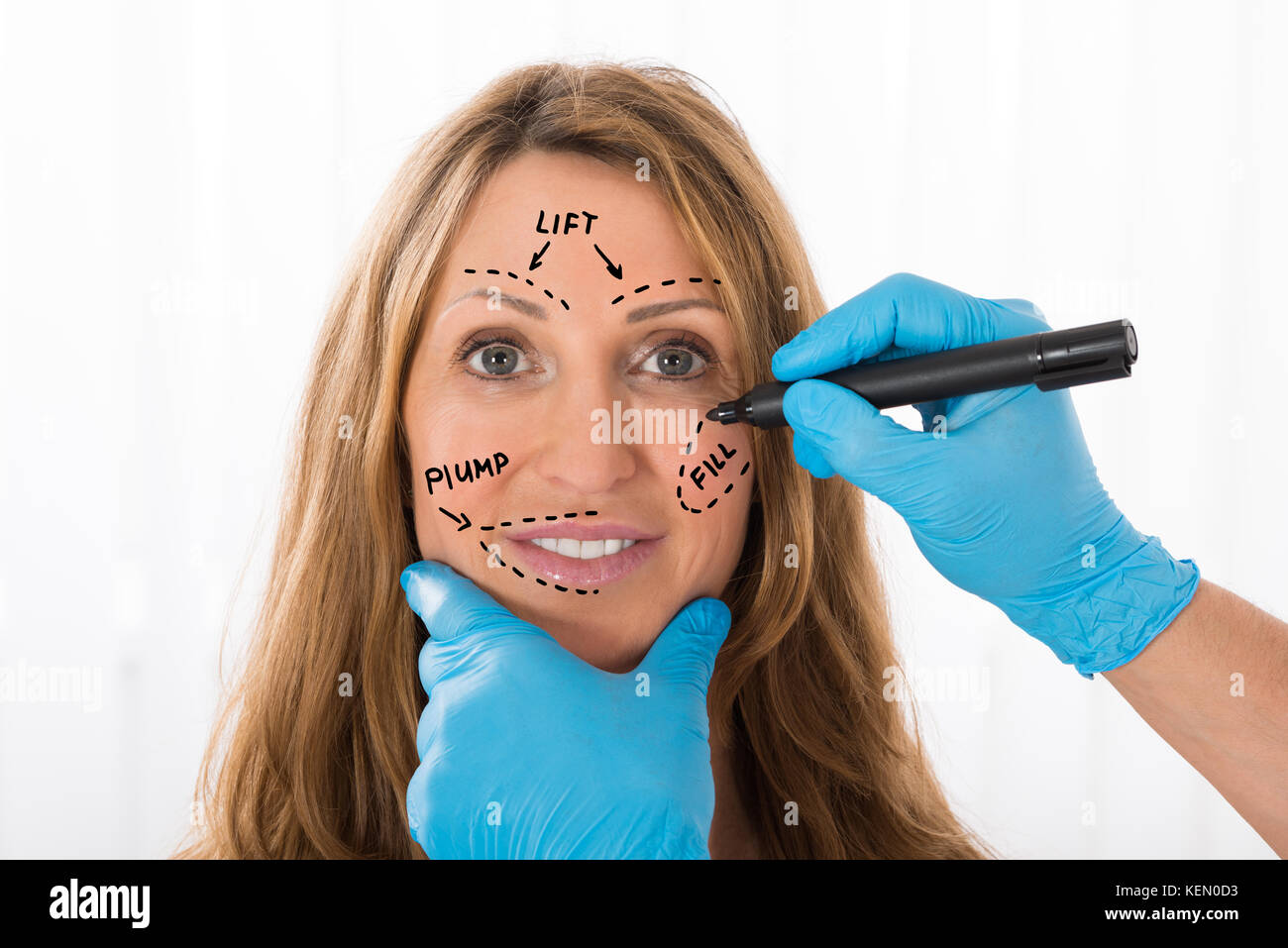 Woman marked plastic surgery hi-res stock photography and images - Alamy