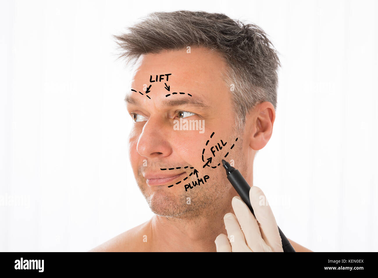 Plastic surgery face marker hi-res stock photography and images - Alamy