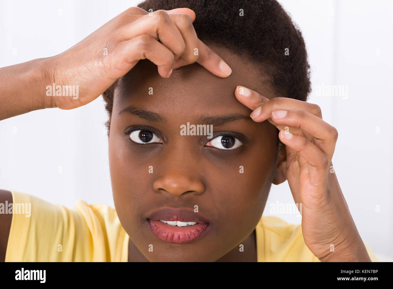 African pimples hi-res stock photography and images - Alamy