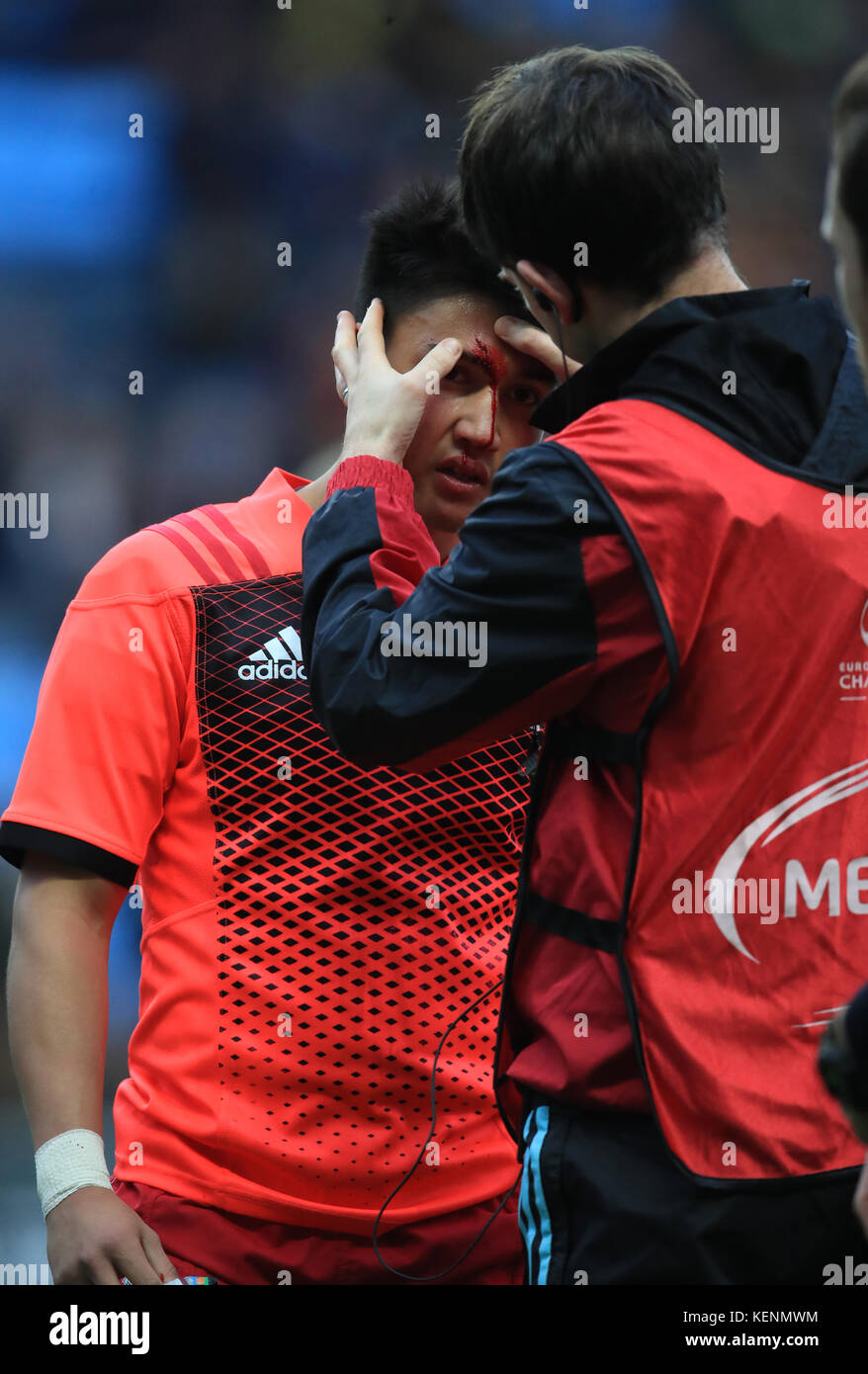 Harlequins' Marcus Smith leaves the field during the warm up with a cut ...