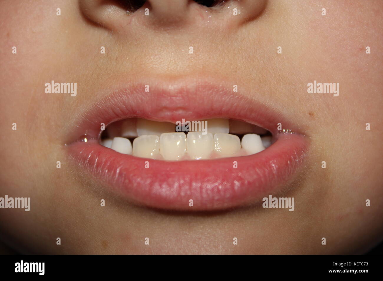 kids teeths - closeup look Stock Photo - Alamy