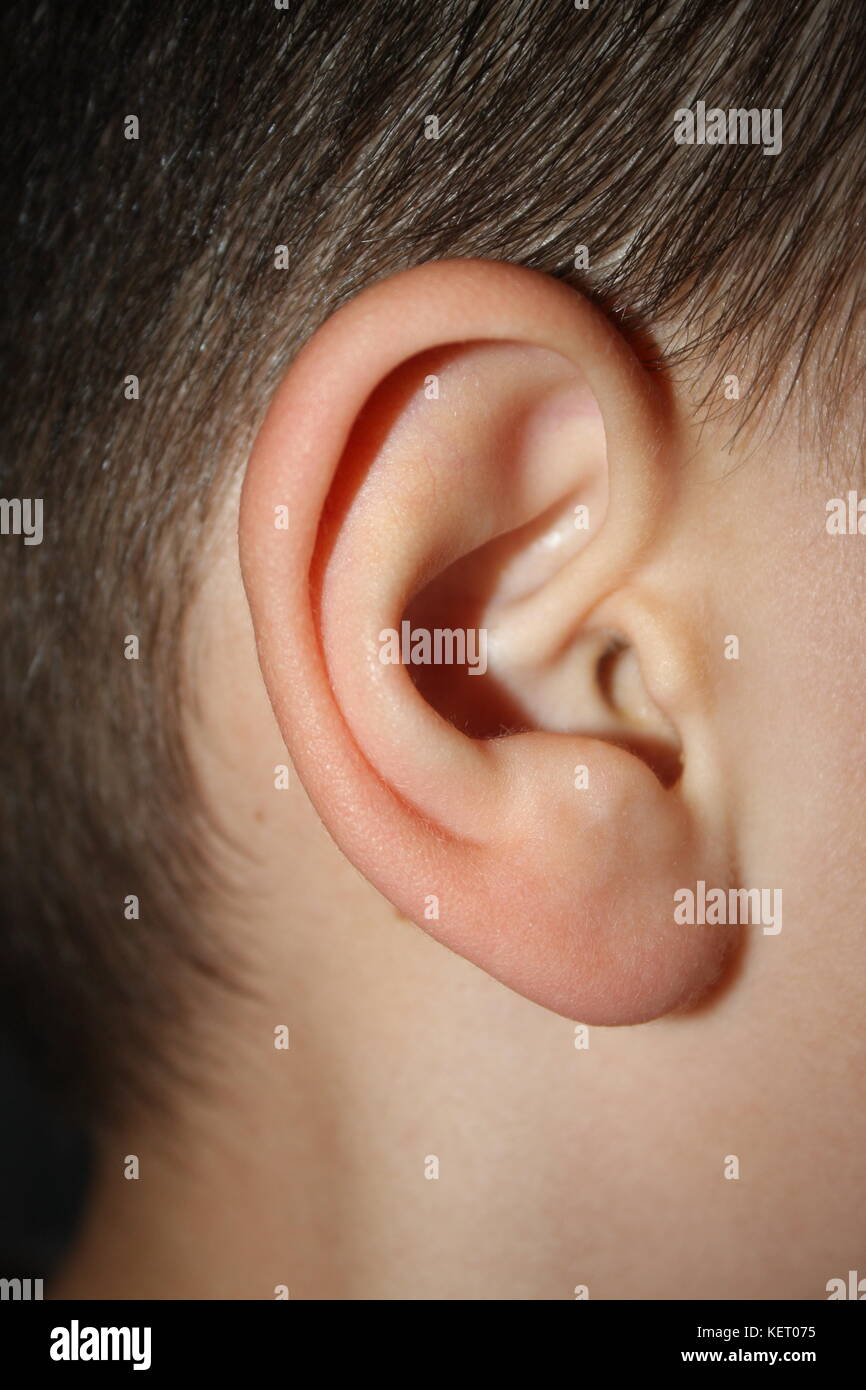 Outer ear infection hi-res stock photography and images - Alamy