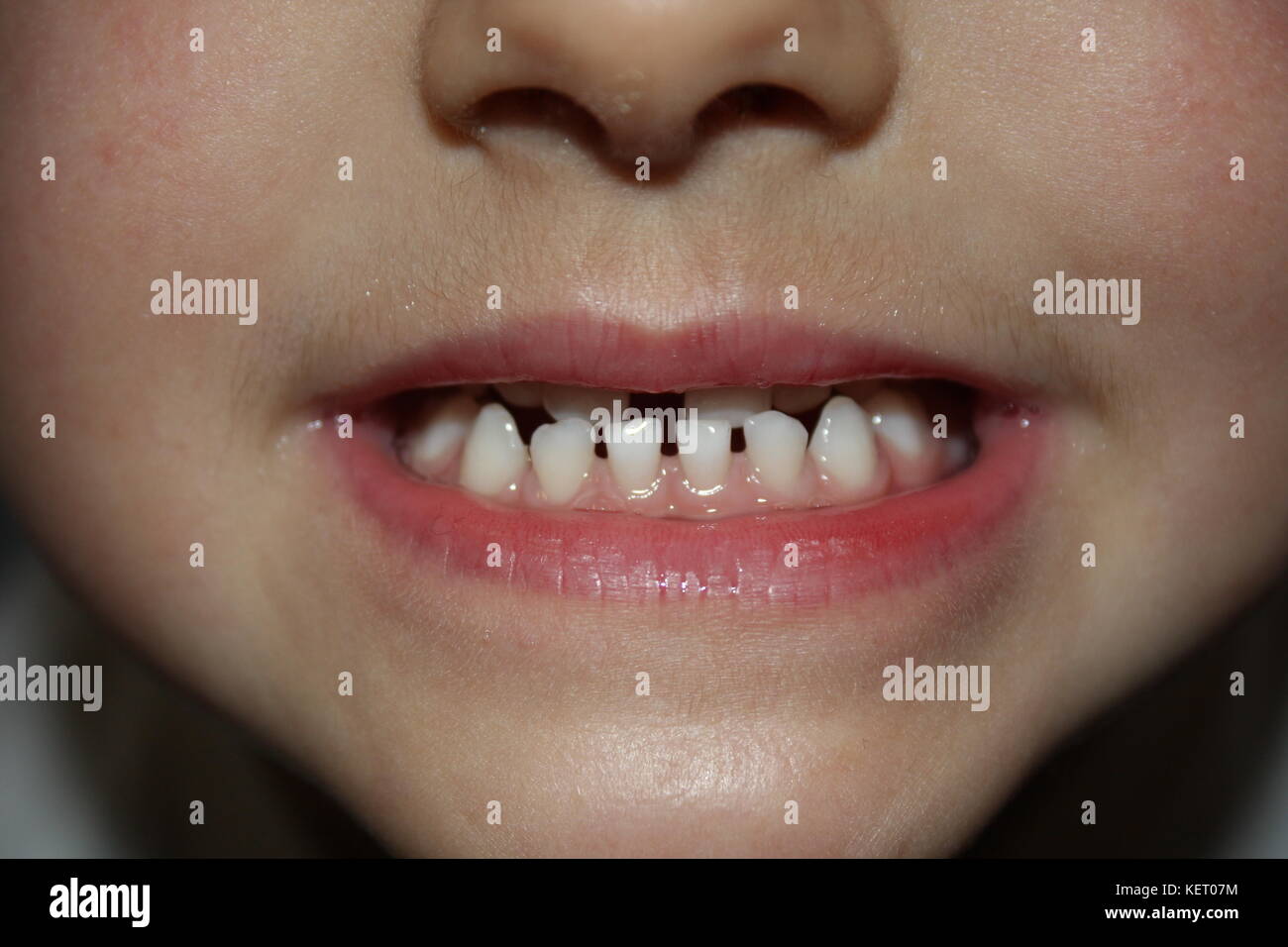 kids teeths - closeup look Stock Photo - Alamy