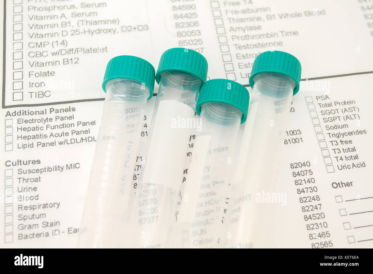 tube empty For the experiment blood samples and screening on form ...