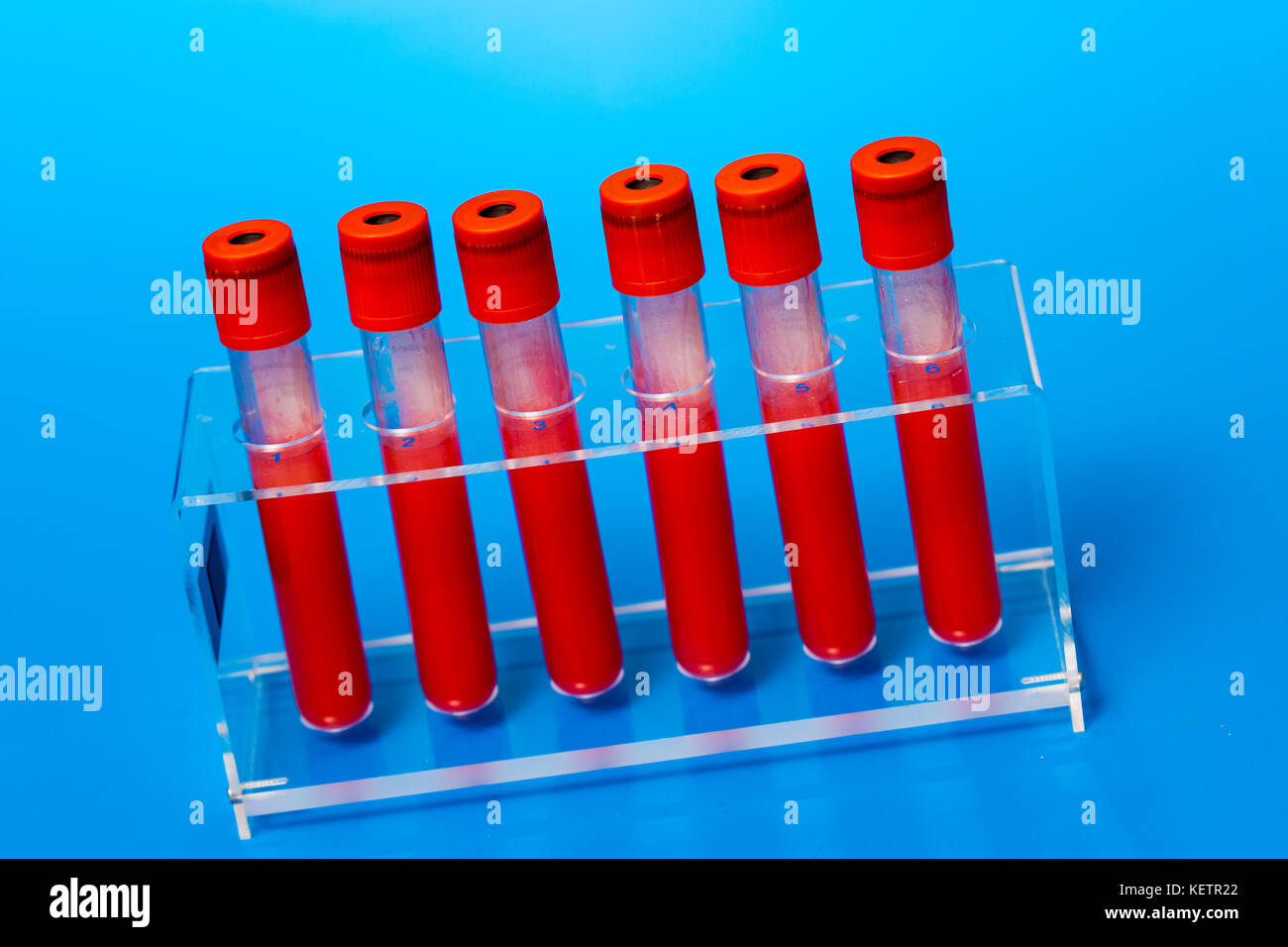 Test tubes with blood for medical and biological analyzes Stock Photo ...