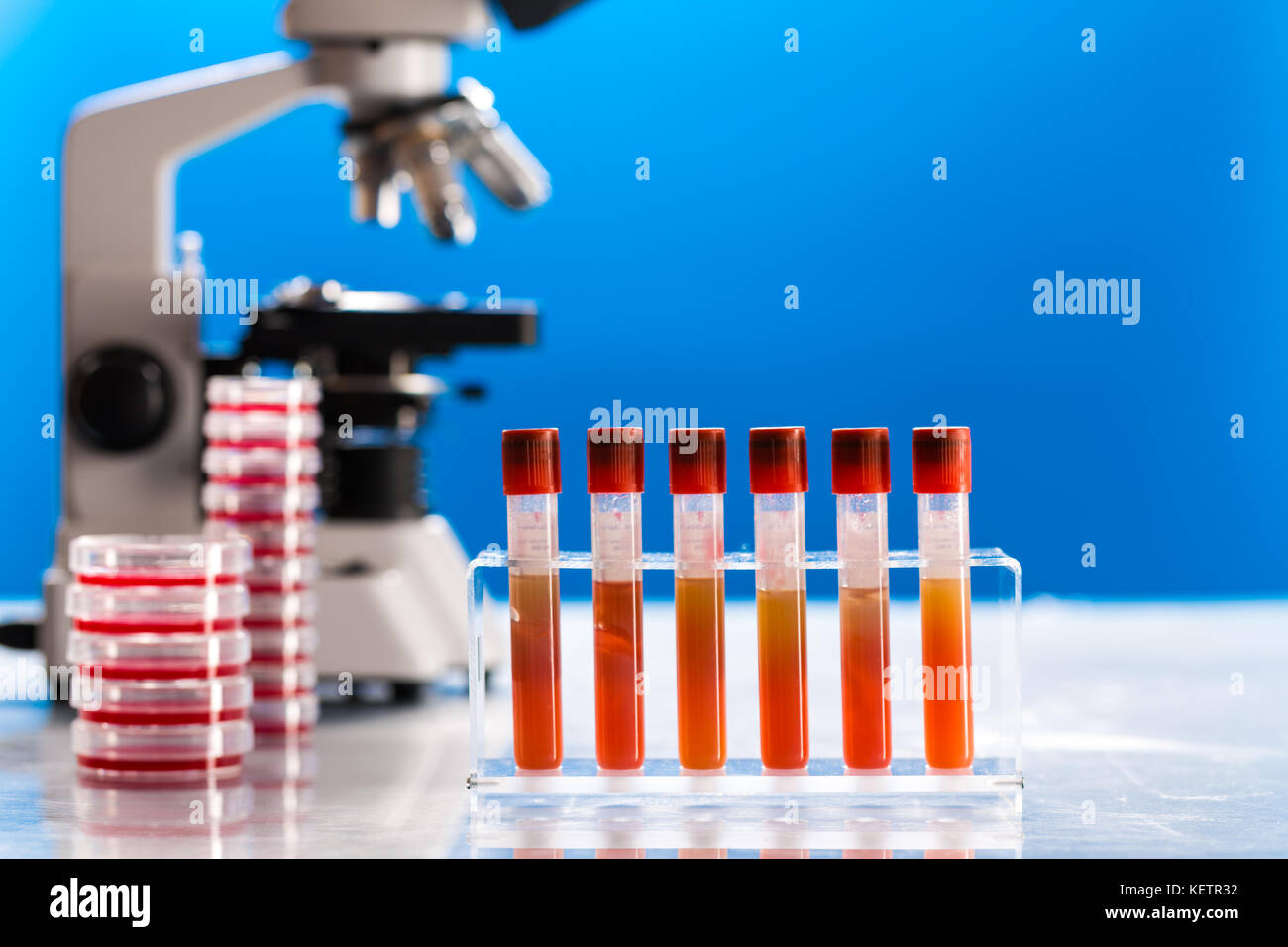 Identification of pathogenic microbes and viruses Stock Photo - Alamy