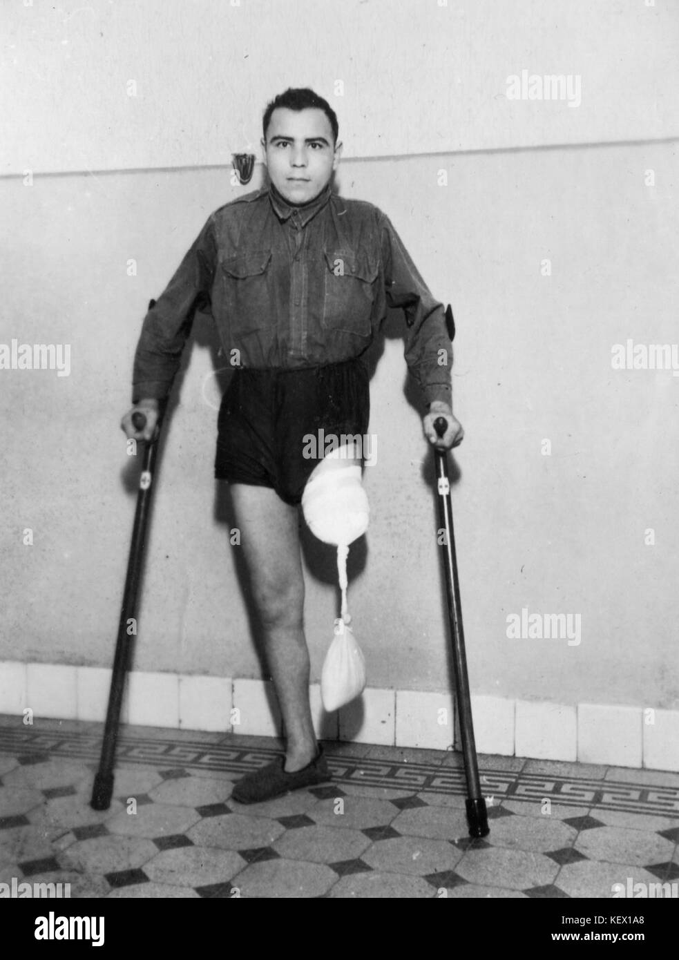 Amputation her Black and White Stock Photos & Images - Alamy