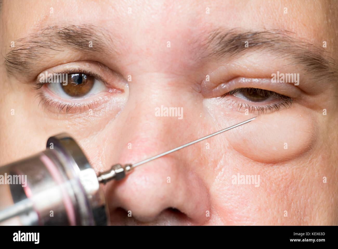 Examination of the sick eye and eyelid in the hospital. Doctor with ...