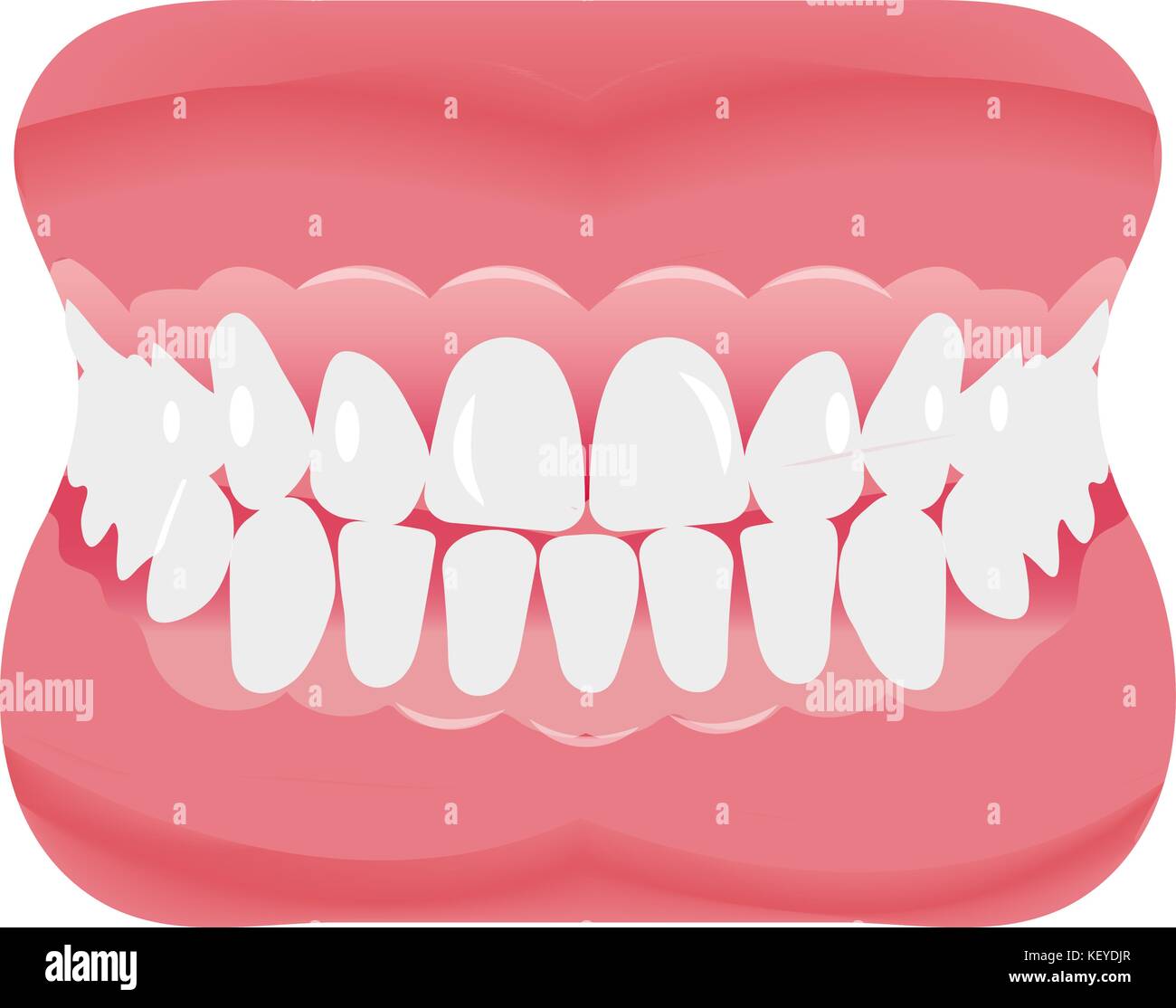3d open denture isolated on Stock Vector Images - Alamy